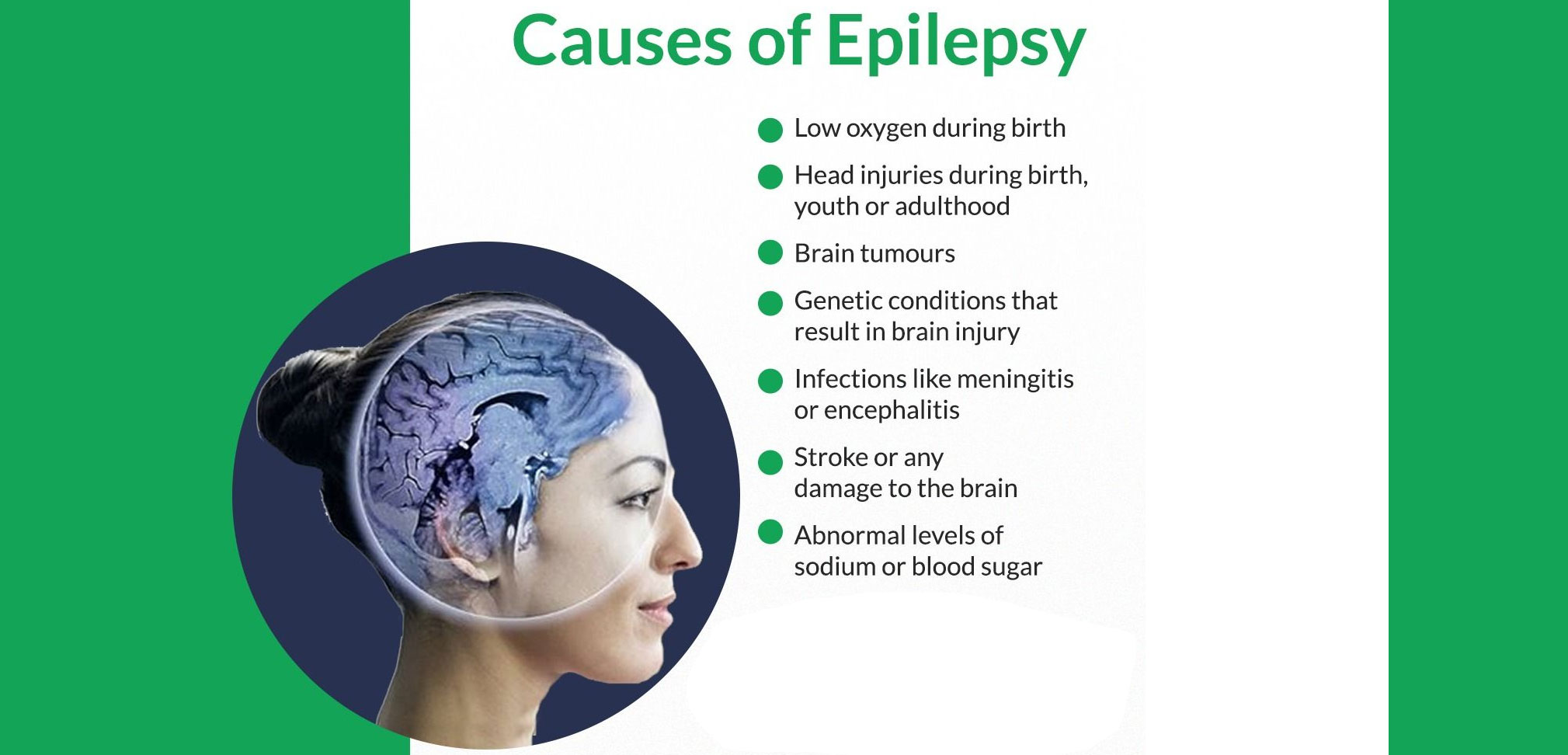 What Are the 5 Symptoms of Epilepsy? - Oxford Hospital | Multi Super ...